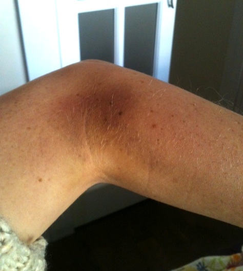 C-section booked! | Yeah, Science!